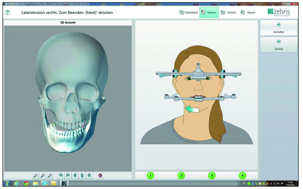 Funktionsanalyse mit Zebris JMA